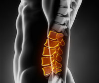 Atlanta GA - Spine Surgery - Dr. Plas James MD
